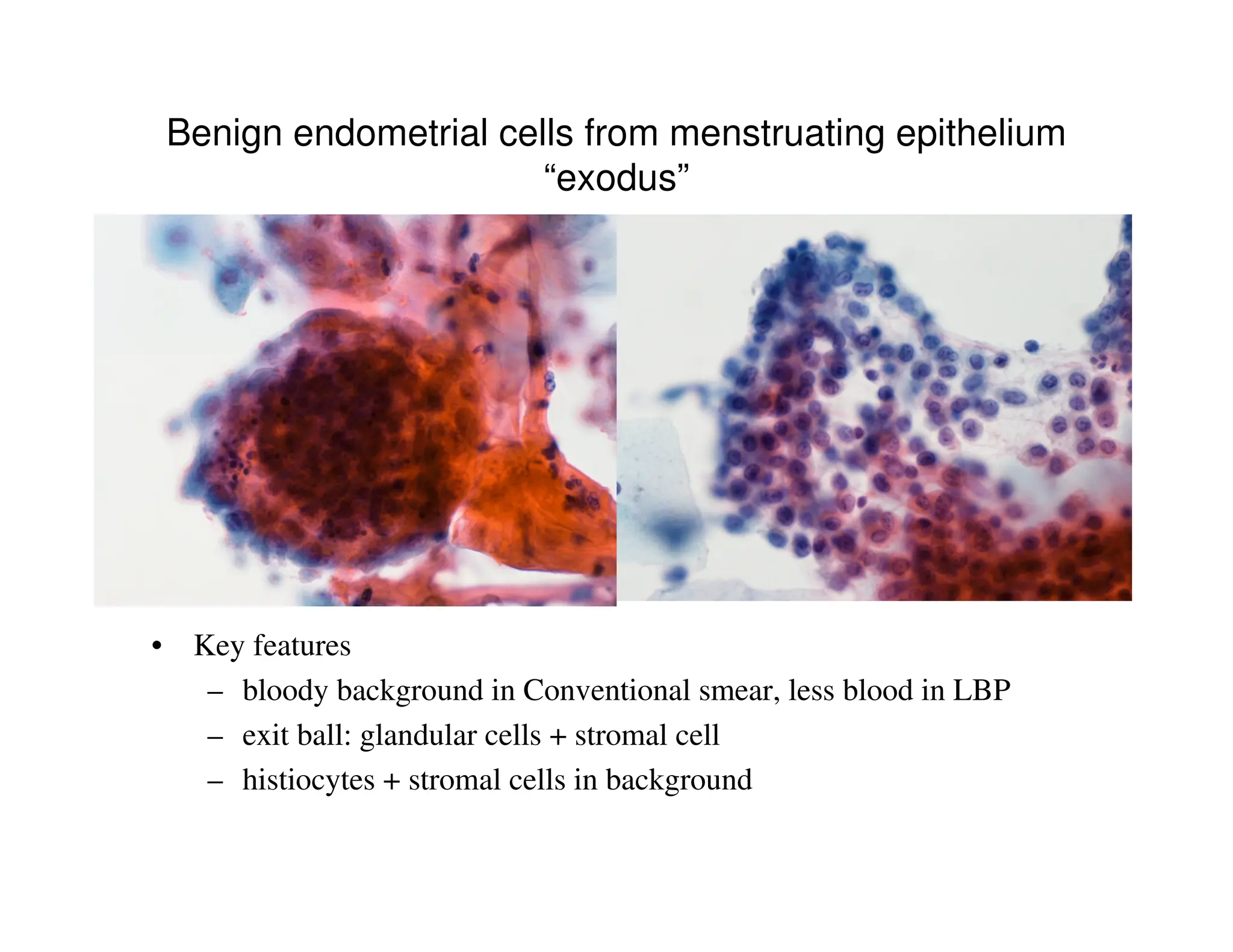 GLANDULAR LESIONS CYTOLOGY IN CERVICAL CYTOLOGY.pdf