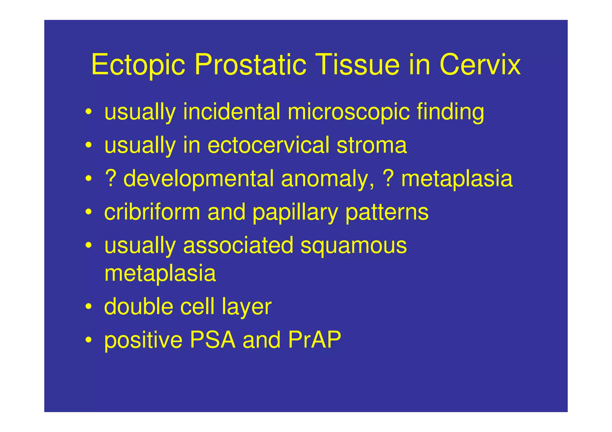 GLANDULAR PATHOLOGY UTERINE CERVIX.pdf