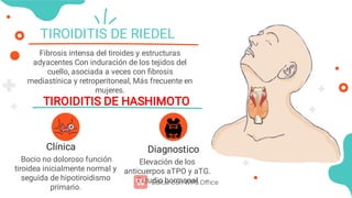 GLANDULAS TIROIDES 2.pdfhhhhhhhhhjjjjjbb | PDF