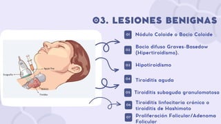 GLÁNDULA TIROIDEA. Presentacion y repaso | PDF