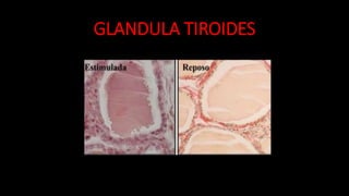 GLANDULA TIROIDES - FISOLOGIA Y ANATOMIA | PPTX