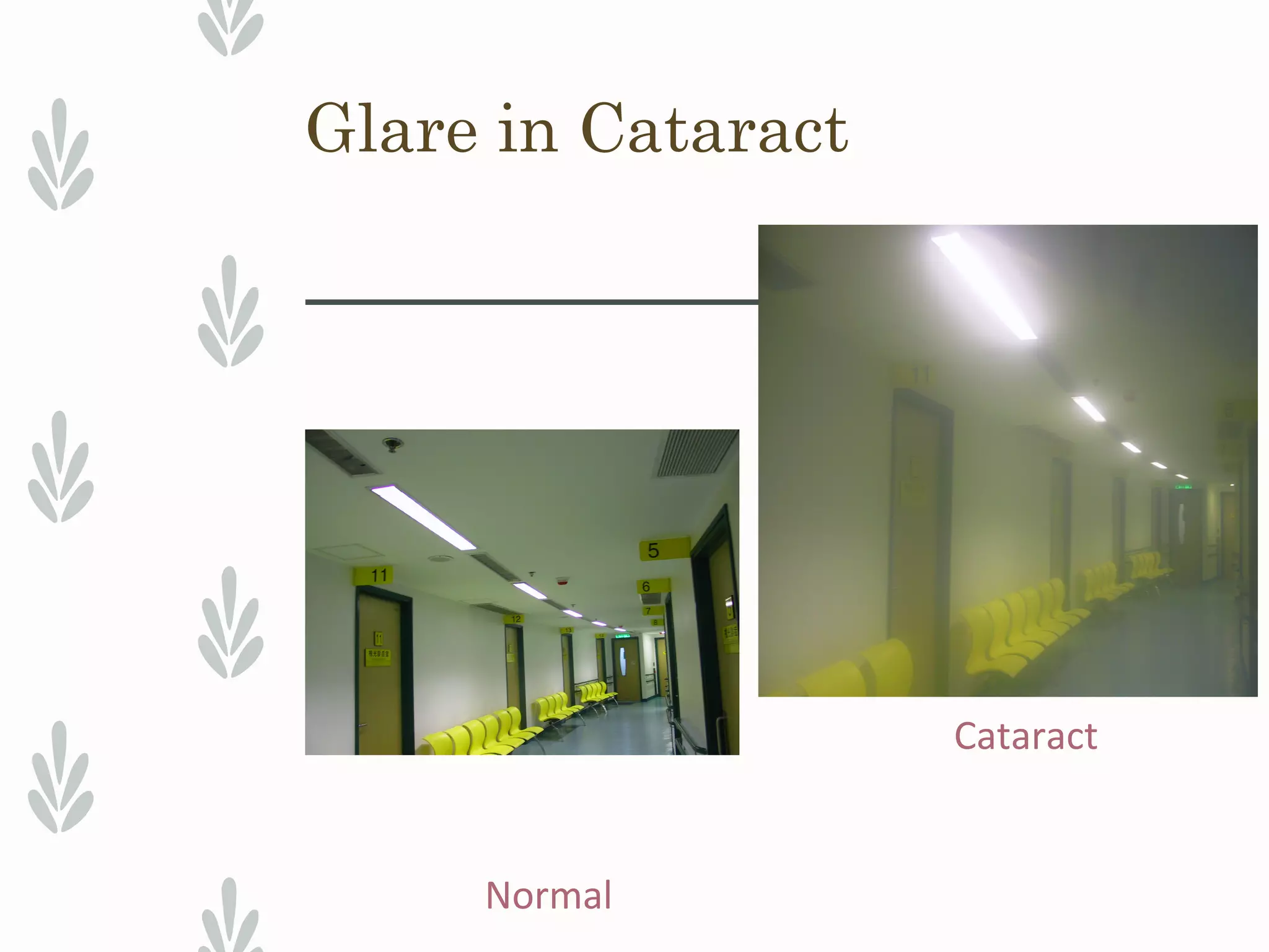 Glare testing and dark adaptation | PPT