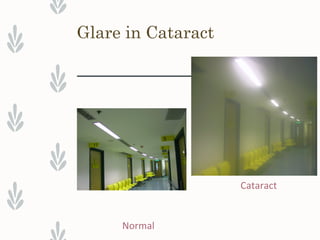 Glare testing and dark adaptation | PPT