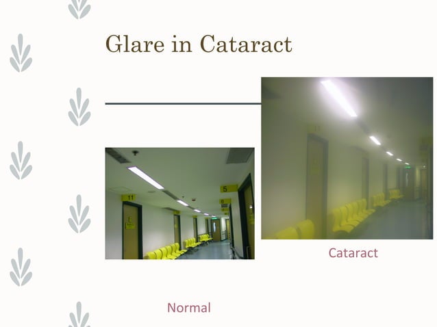 Glare Testing And Dark Adaptation Ppt