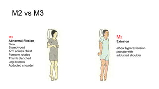 Glasgow coma scale | PPTX