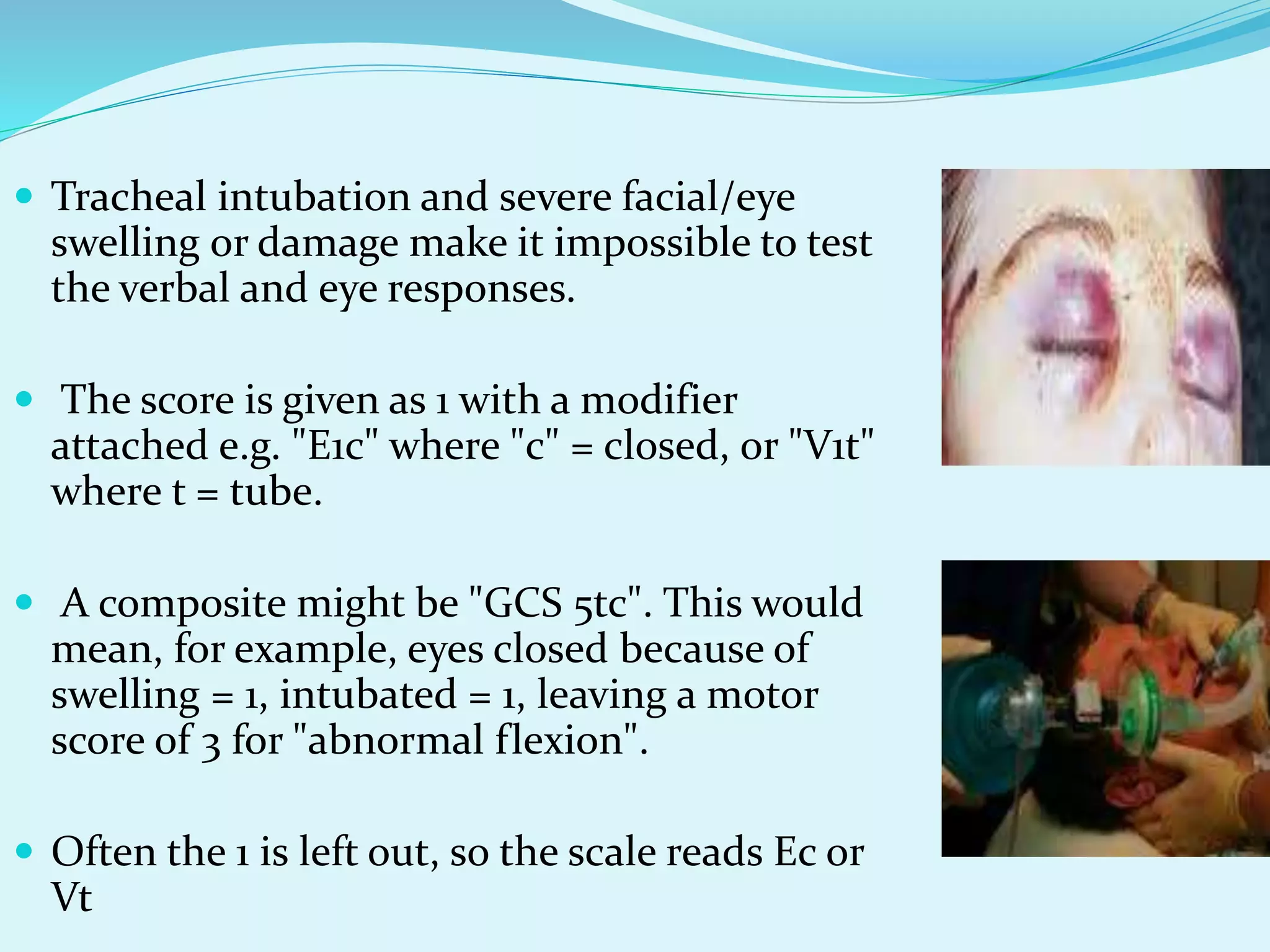 Glasgow coma scale evaluation and clinical considerations | PPTX