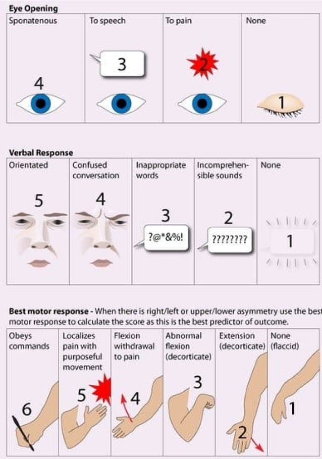 Glasgow Coma Scale Flow Chart Severity of head injuries in head trauma ...