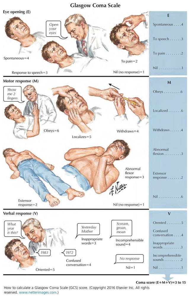 Glasgow Coma Scale Flow Chart Severity of head injuries in head trauma ...