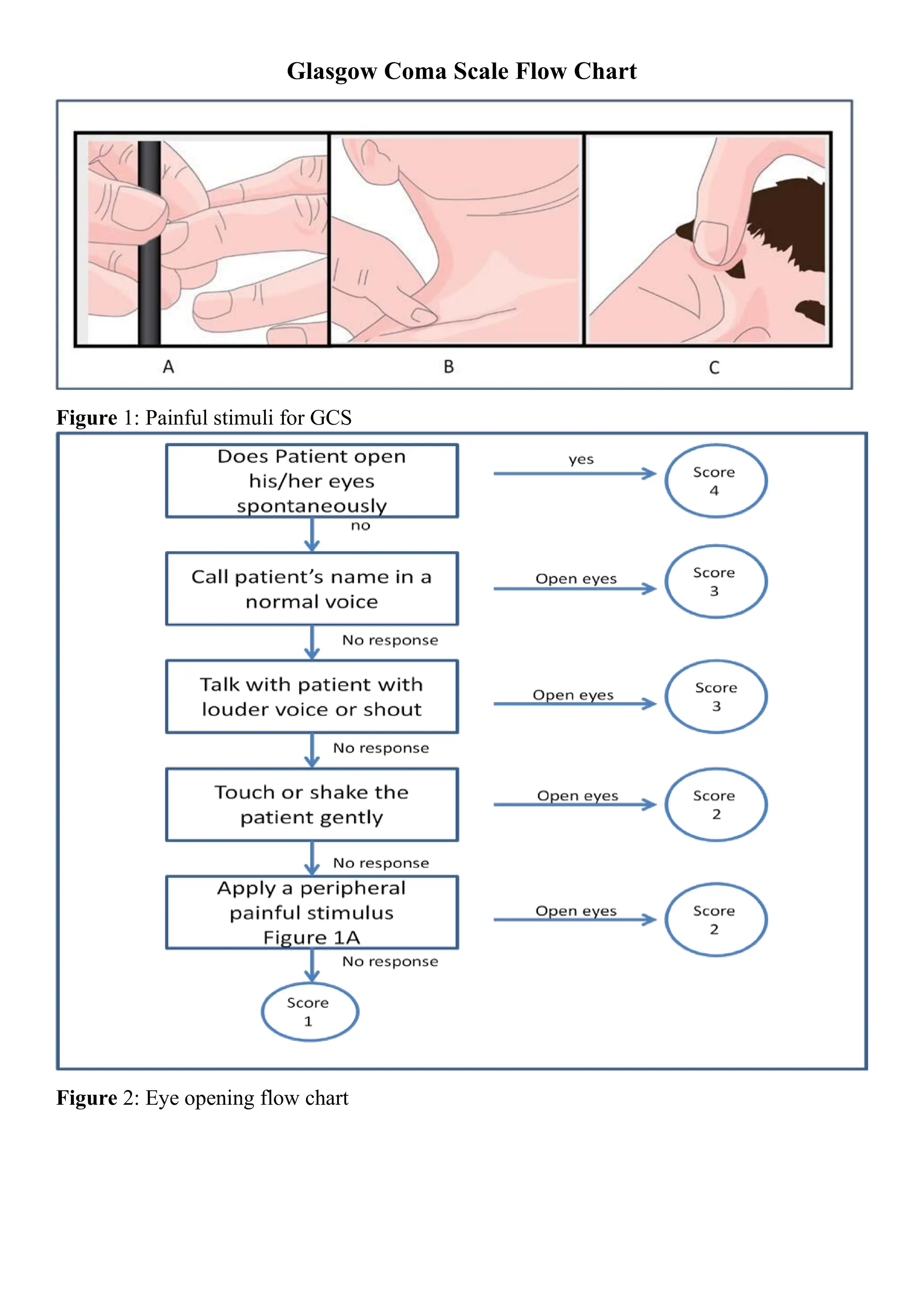 Glasgow Coma Scale Flow Chart to determin the severity of head injury.pdf