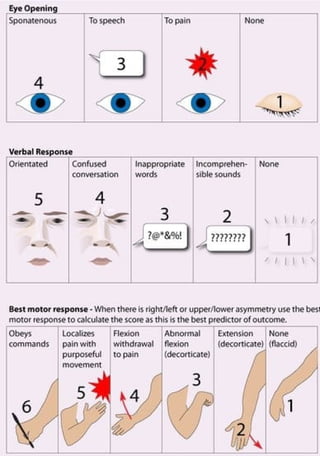 Glasgow Coma Scale Flow Chart to determin the severity of head injury.pdf
