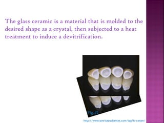 Glass ceramics dental materials | PDF