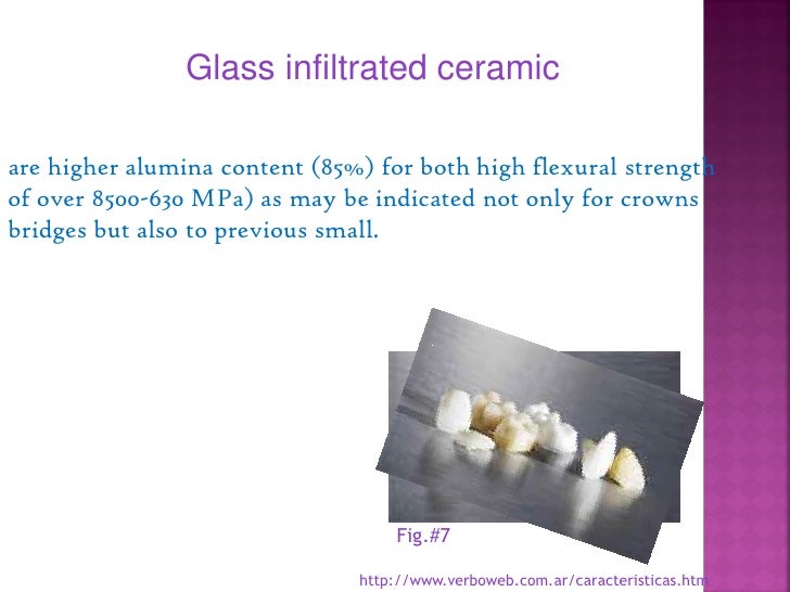 Glass Ceramics Dental Materials