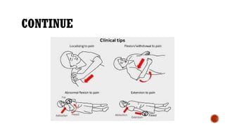 Presentation on glasscoma scale in nursing | PPT