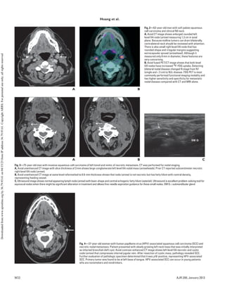 glastonbury-et-al-2013-evaluation-of-cervical-lymph-nodes-in-head-and-neck-cancer-with-ct-and ...