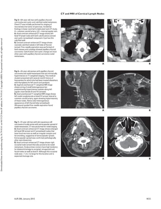 glastonbury-et-al-2013-evaluation-of-cervical-lymph-nodes-in-head-and ...