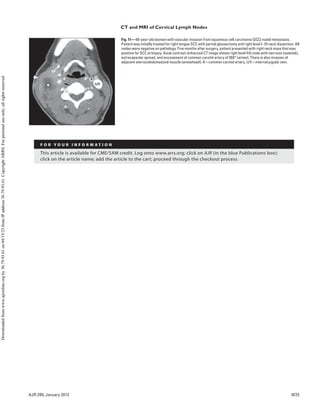 glastonbury-et-al-2013-evaluation-of-cervical-lymph-nodes-in-head-and ...