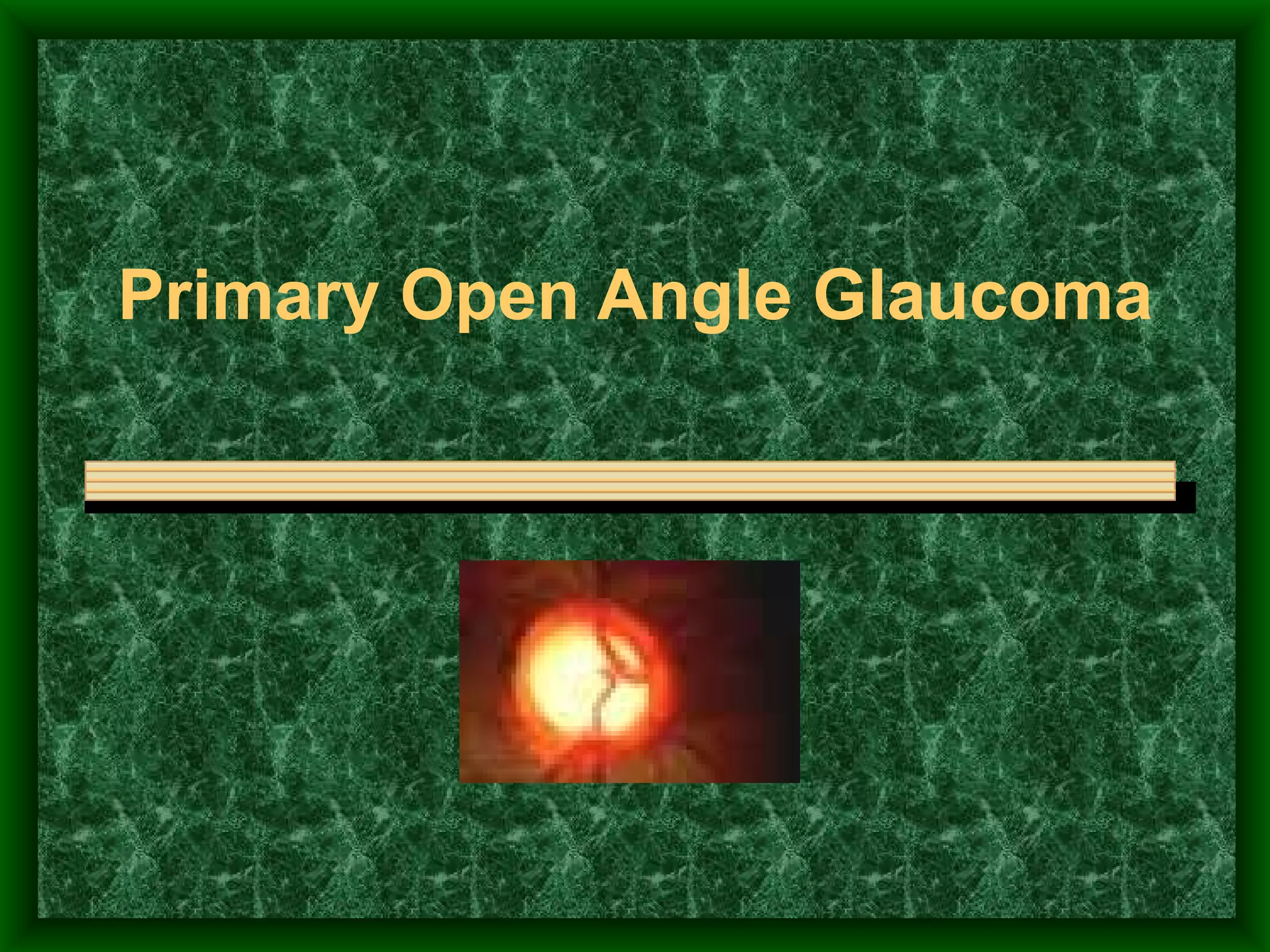 Glaucoma | PPT | Eye and Vision Conditions | Diseases and Conditions