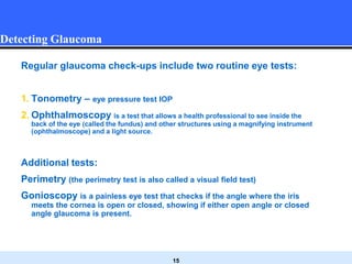 Glaucoma | PPSX