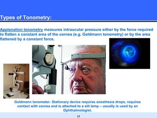 Glaucoma | PPSX