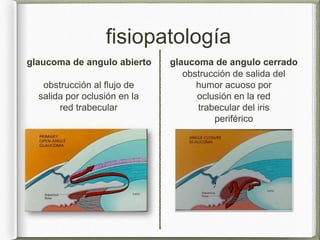 Glaucoma de angulo cerrado y abierto | PPTX