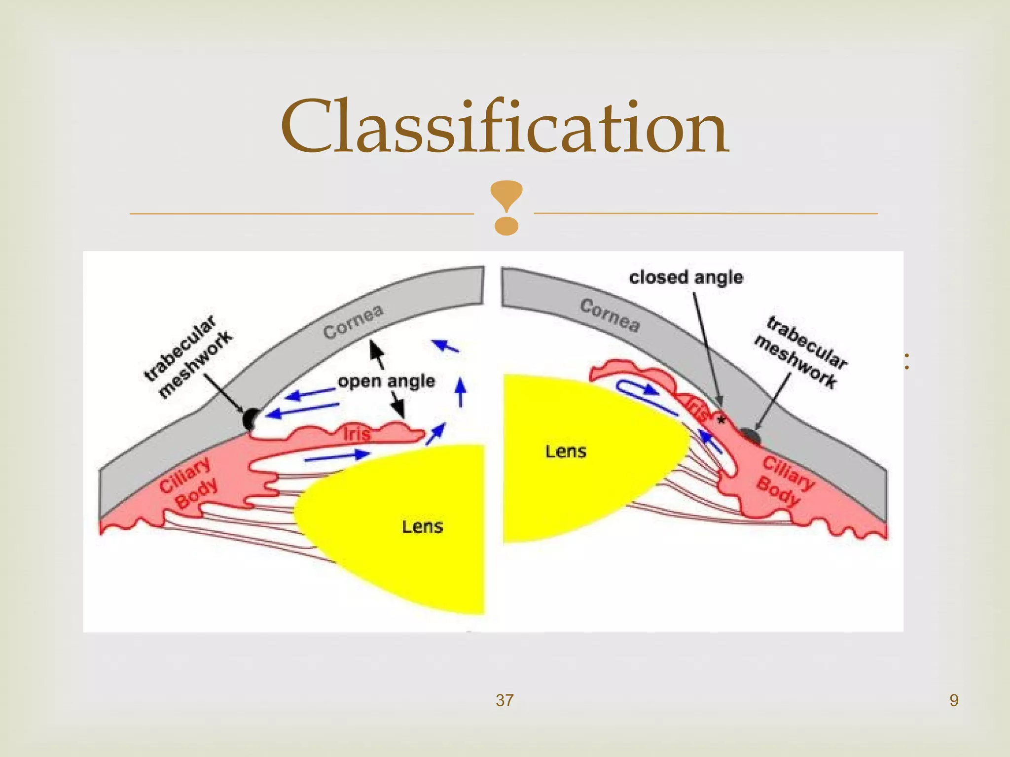 Glaucoma | PPT