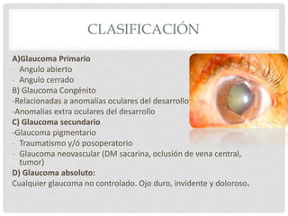 Glaucoma | PPTX