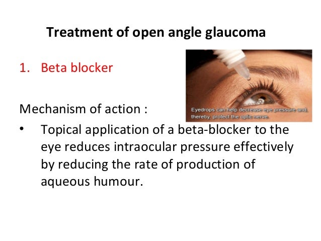 Glaucoma