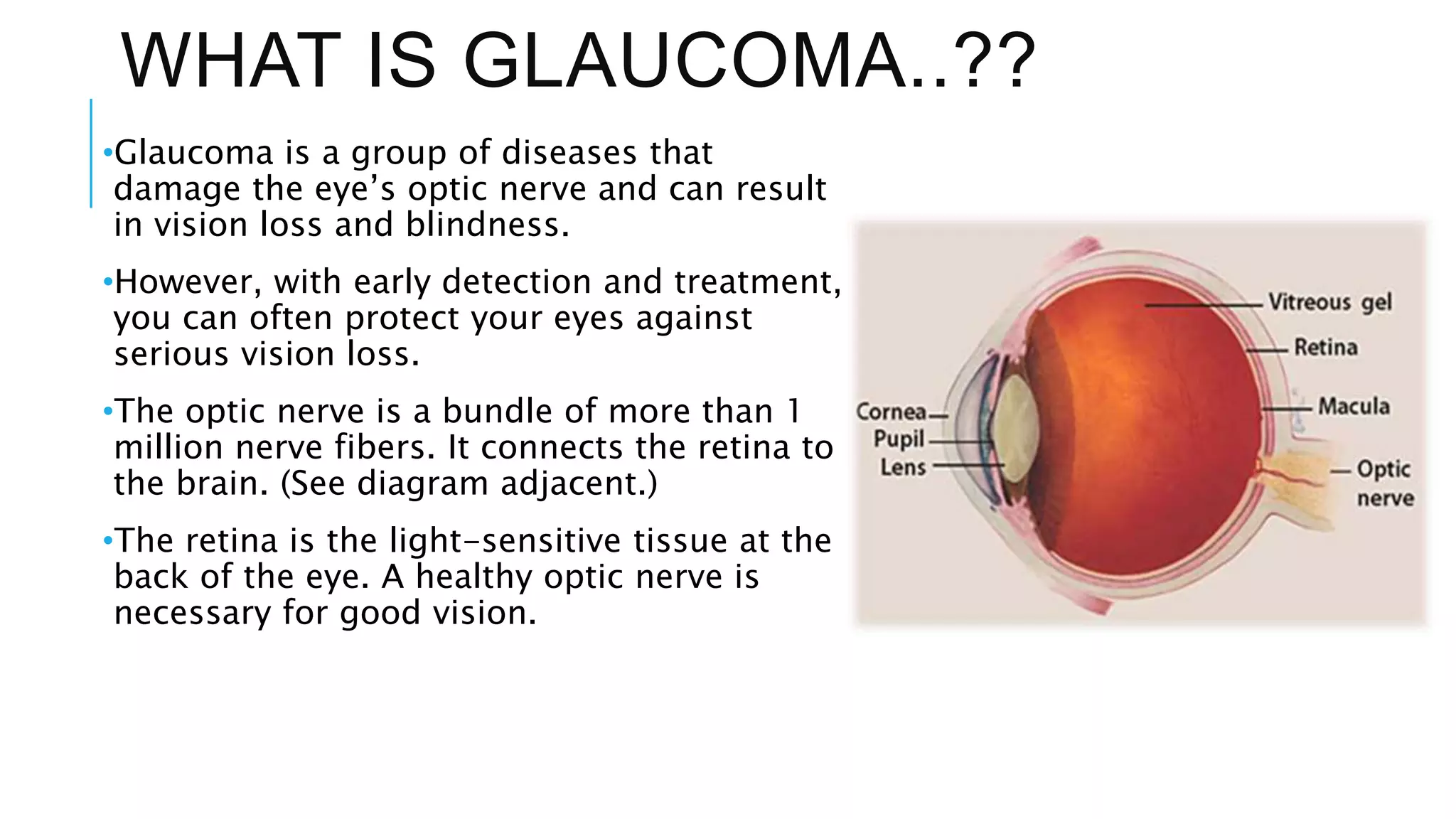 Glaucoma | PPTX
