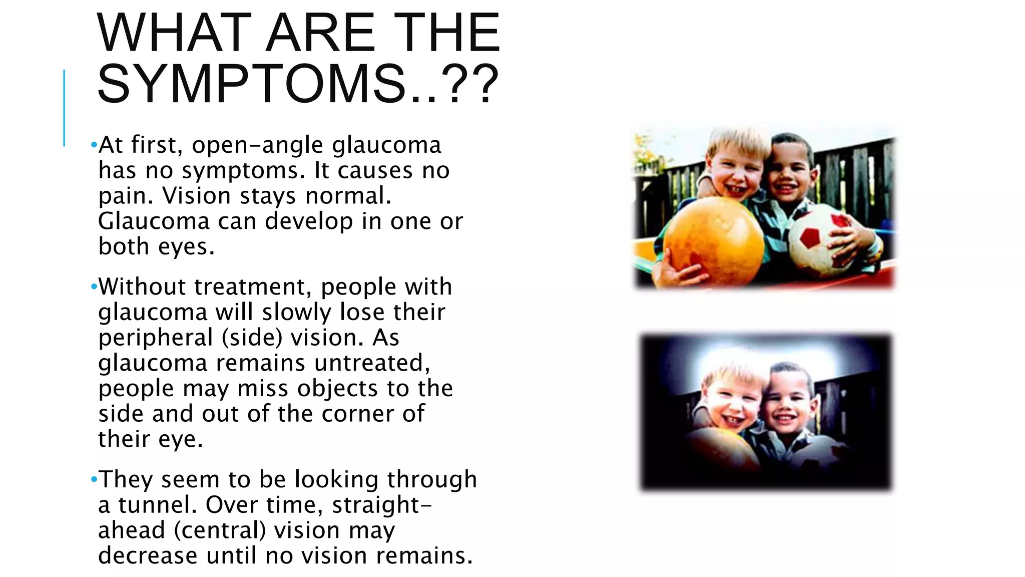 Glaucoma | PPTX