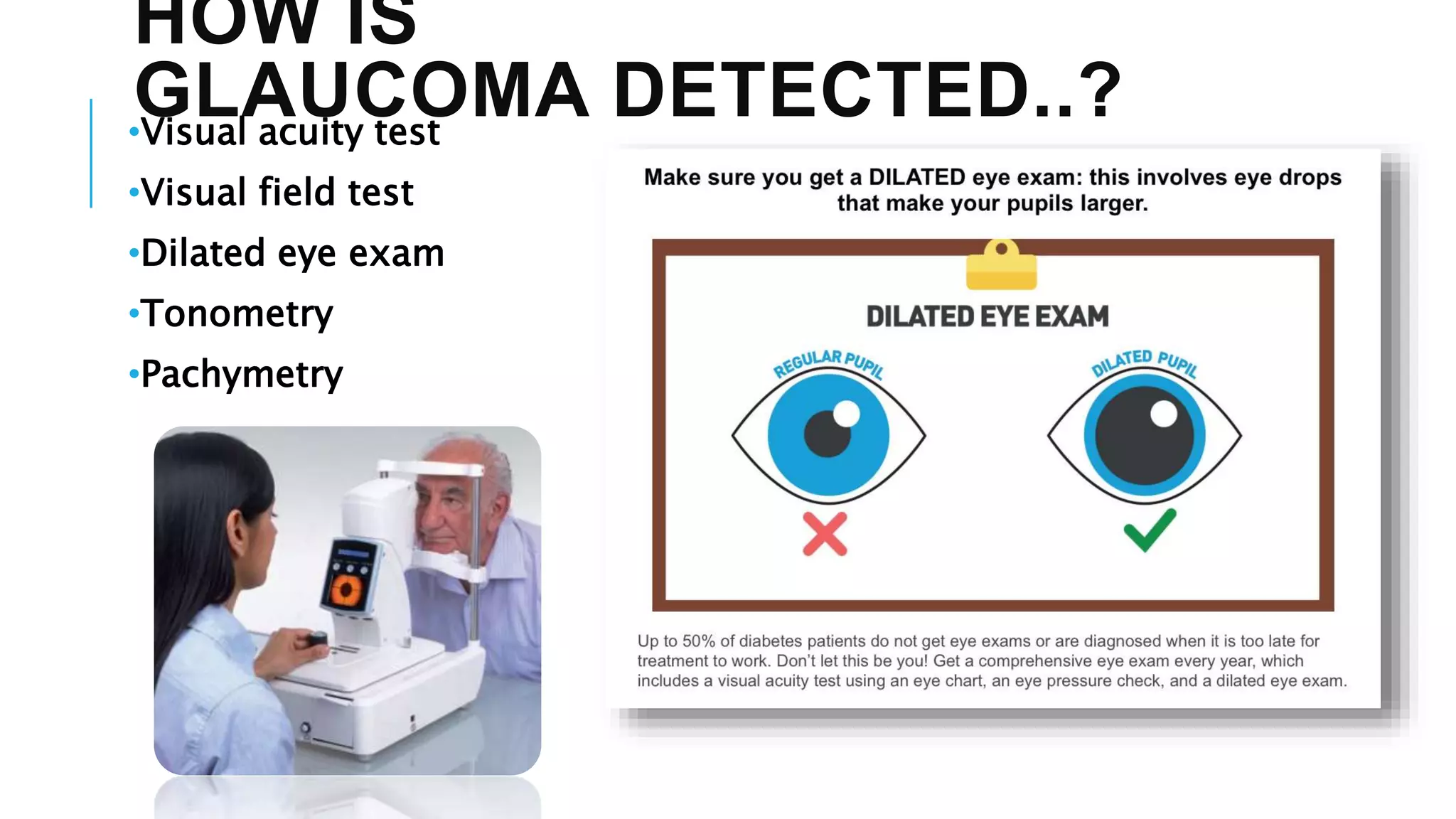 Glaucoma | PPTX