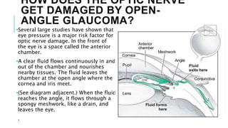 Glaucoma | PPTX