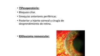 Glaucoma | PPTX
