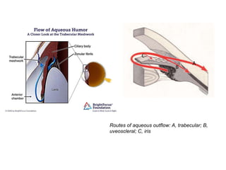 Glaucoma (opthalmology) | PPTX