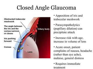 Glaucoma | PPT
