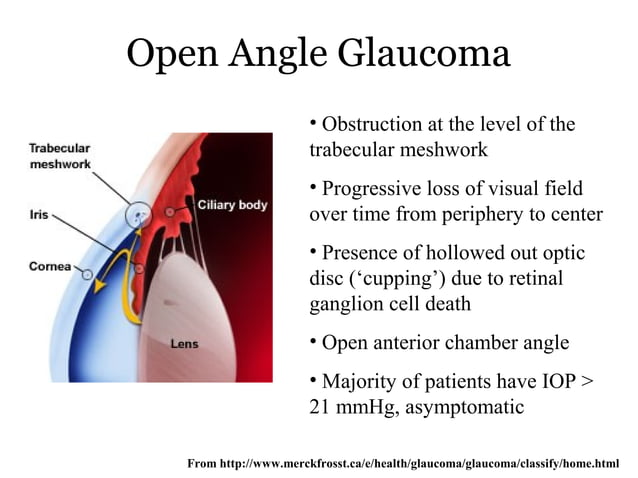 Glaucoma | PPT