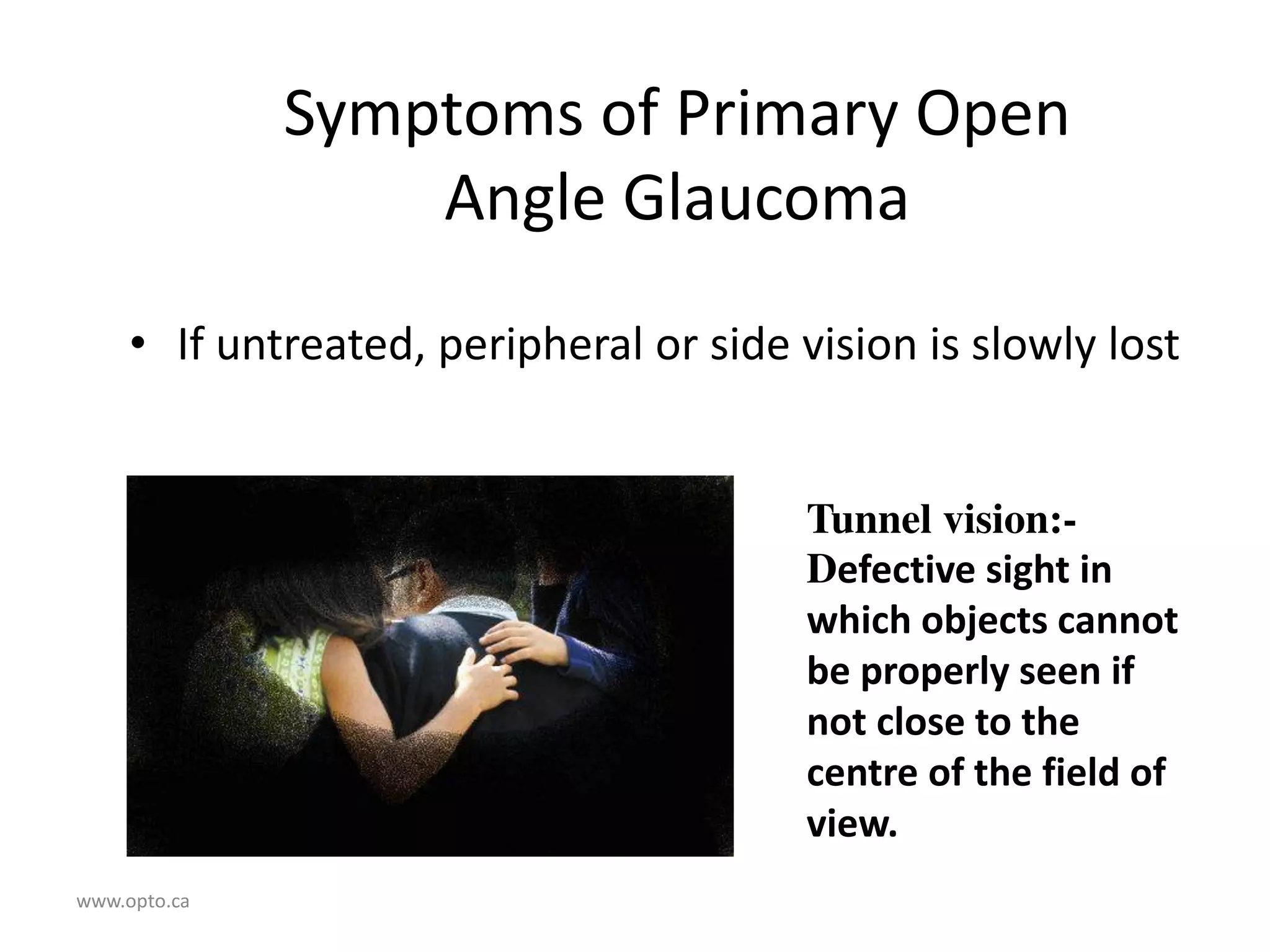 Glaucoma | PDF