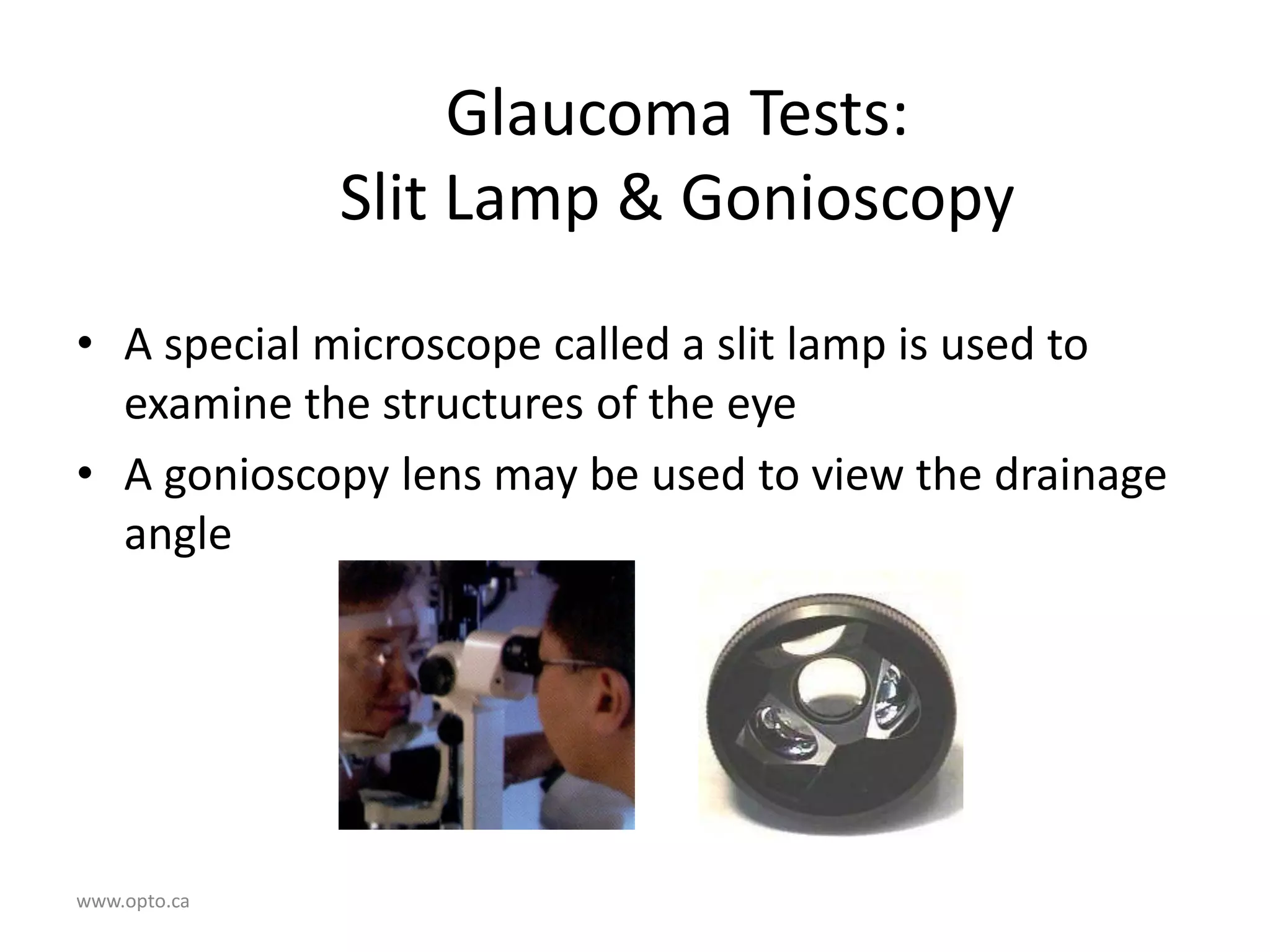 Glaucoma | PDF
