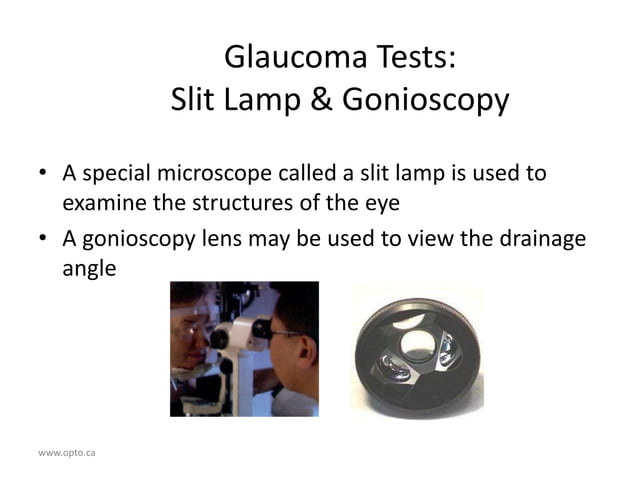 Glaucoma | PDF