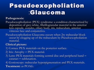 Glaucoma | PPT