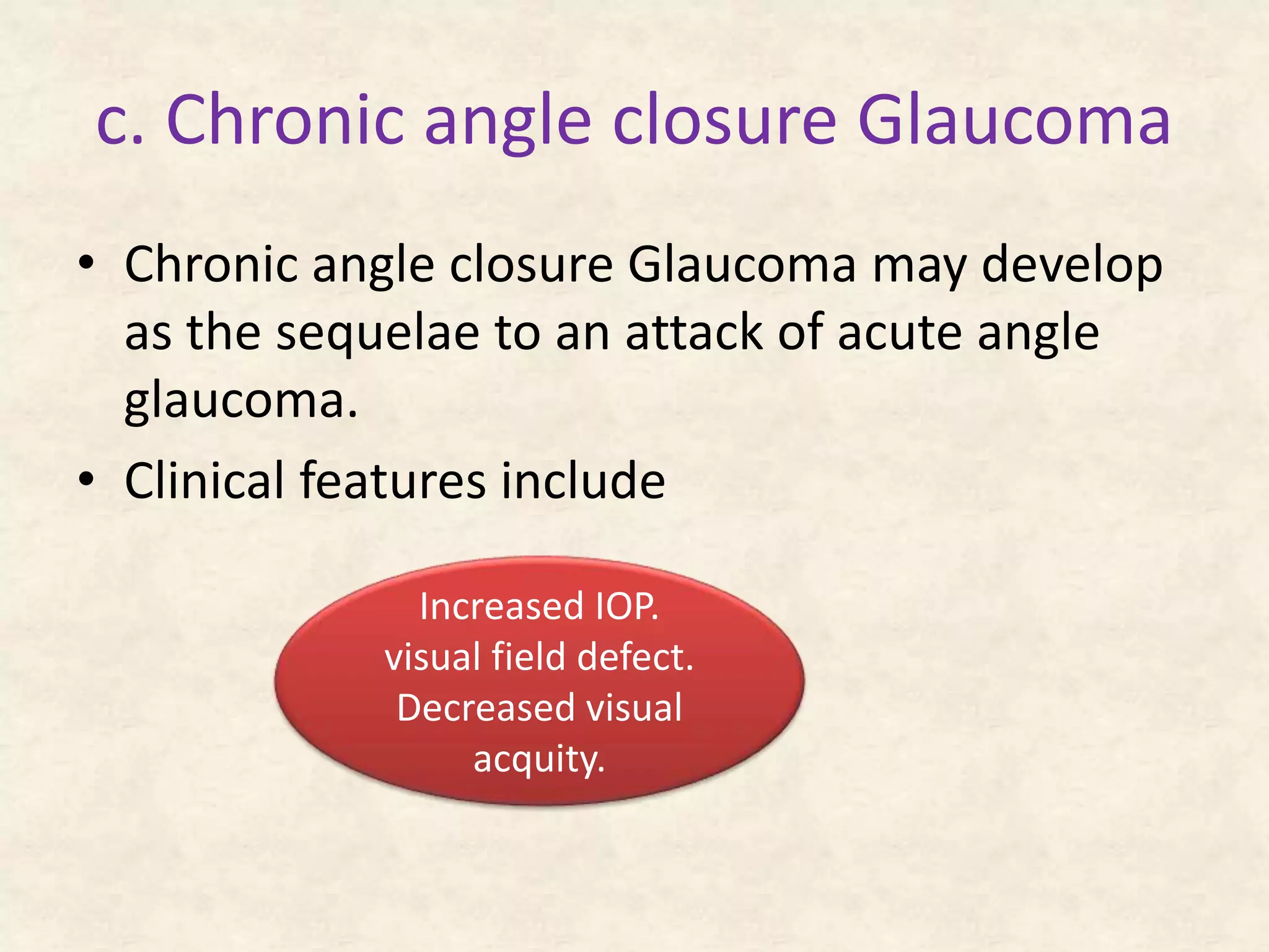 Glaucoma | PPTX
