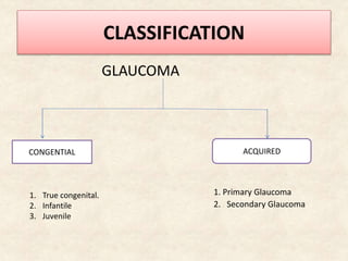 Glaucoma | PPTX
