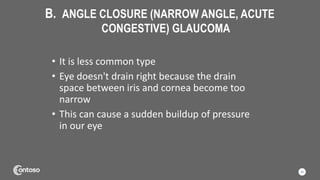 Anti Glaucoma Drugs | PPTX
