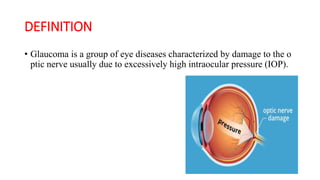 Glaucoma | PPT