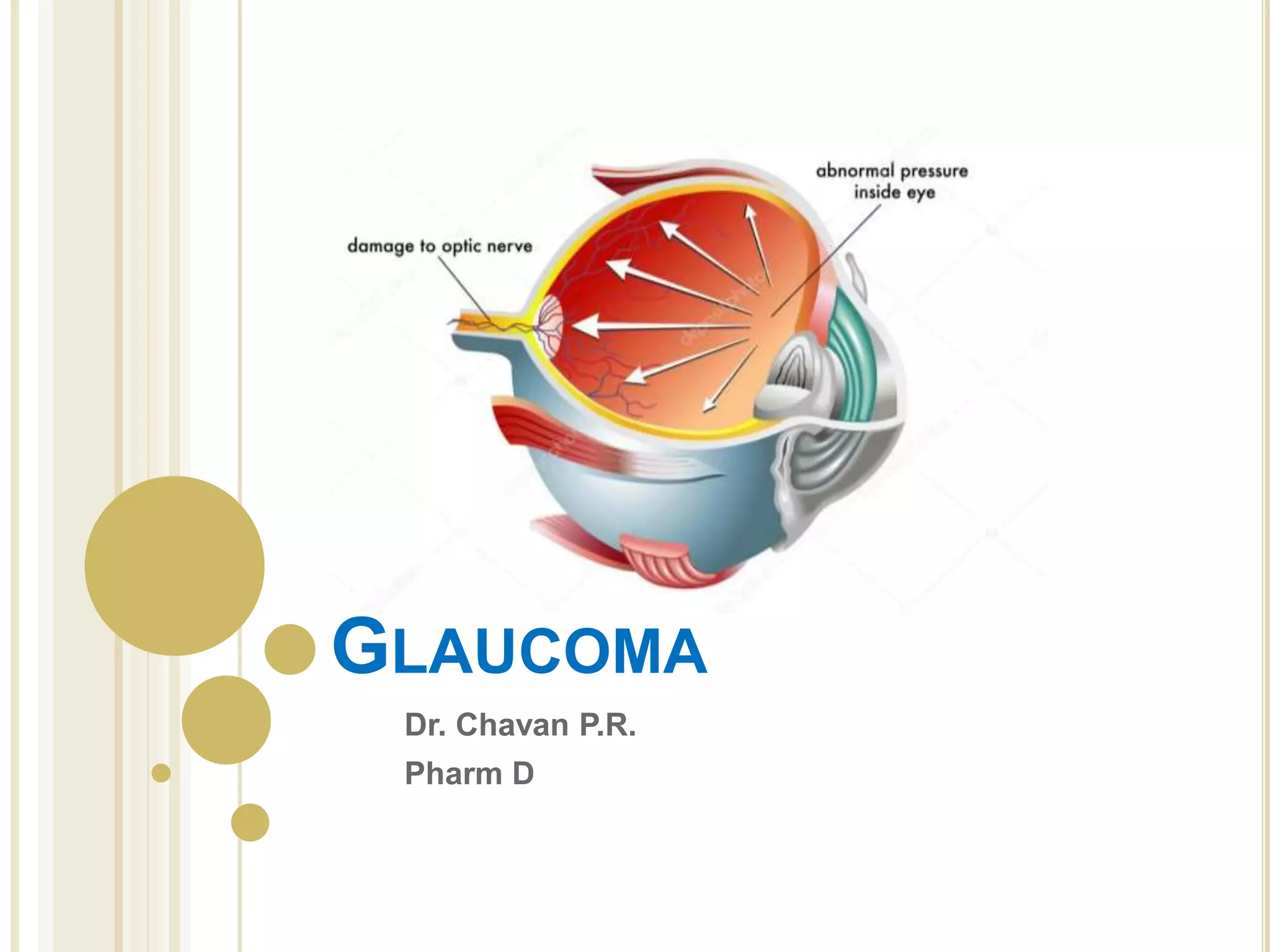 Glaucoma types, Pathogenesis, Diagnosis and Treatment | PPTX