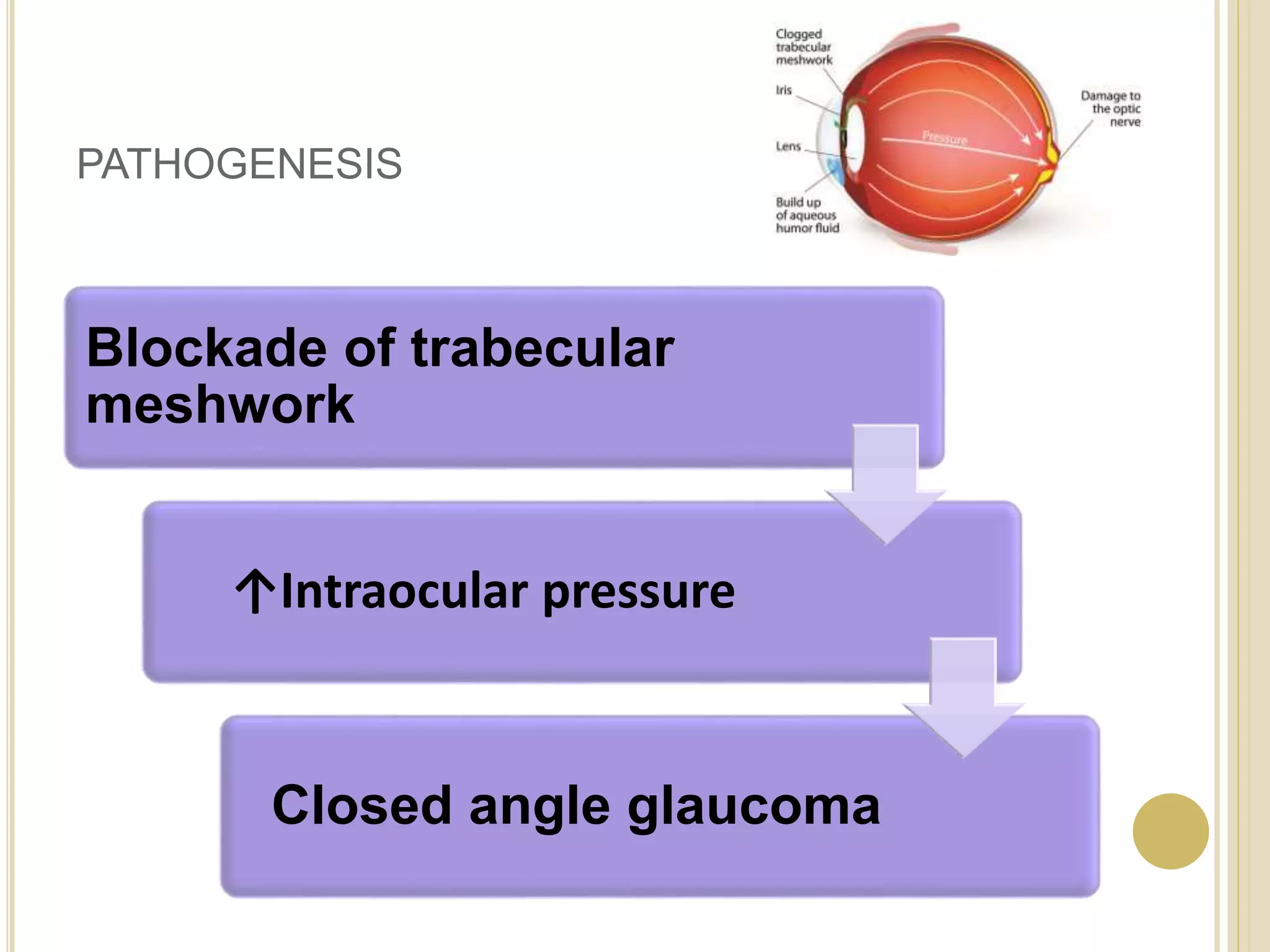 Glaucoma types, Pathogenesis, Diagnosis and Treatment | PPTX