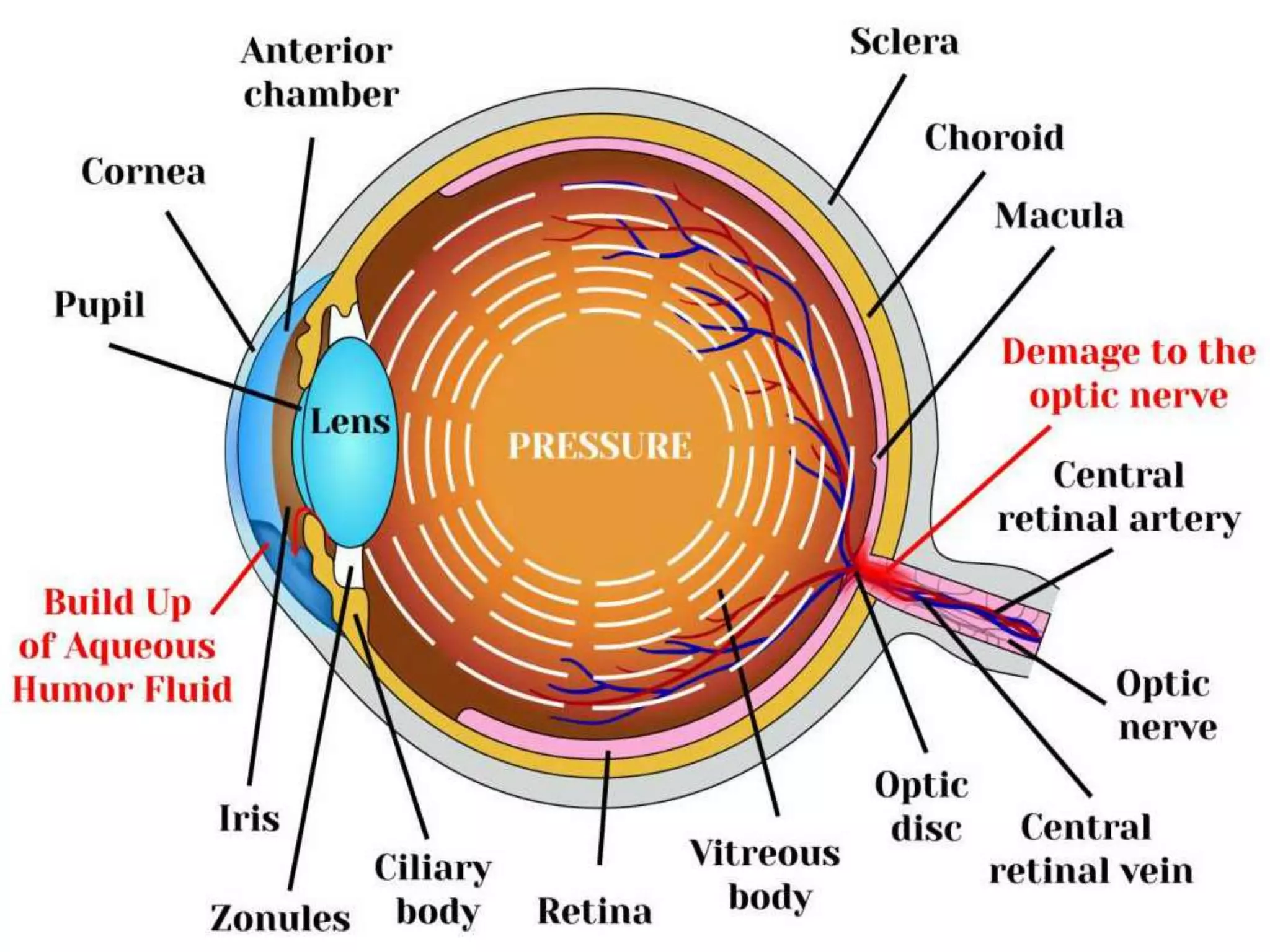Glaucoma types, Pathogenesis, Diagnosis and Treatment | PPTX