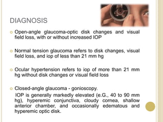 Glaucoma types, Pathogenesis, Diagnosis and Treatment | PPTX