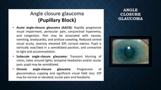 Glaucoma slideshare for medical students | PPTX