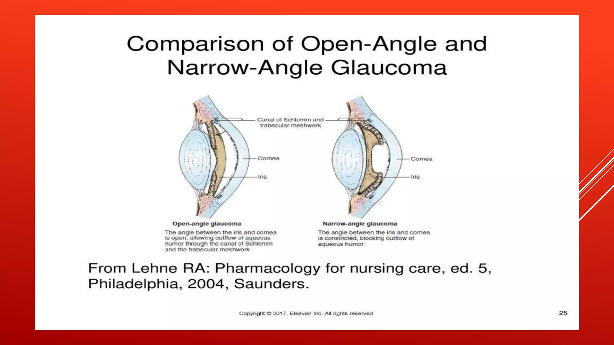 Glaucoma | PPTX