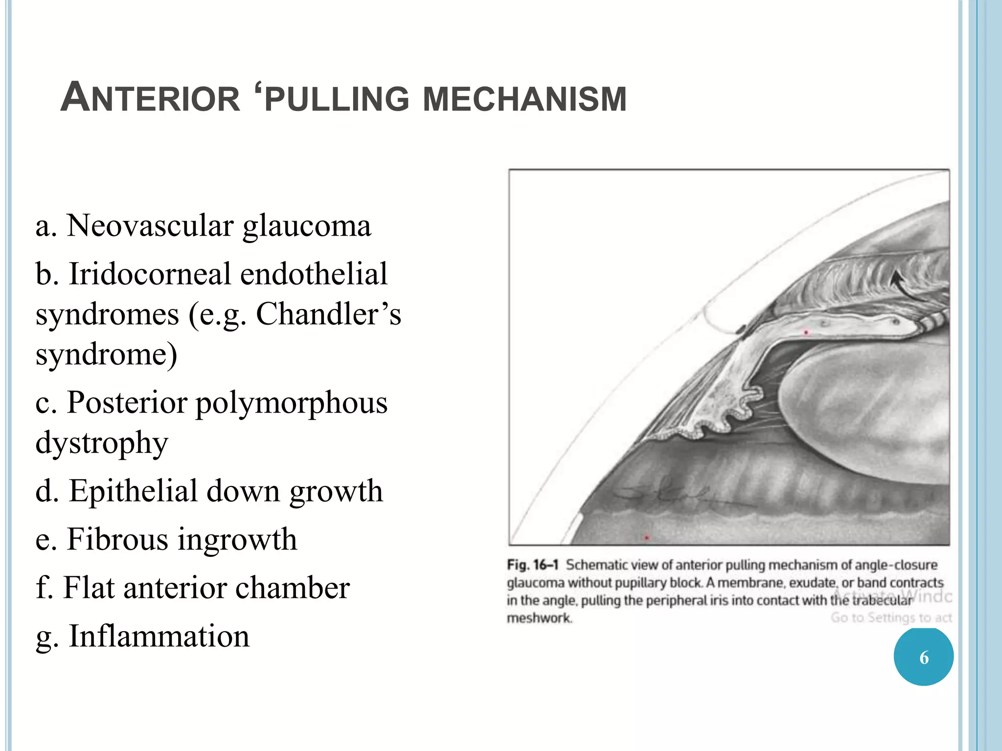 secondary angle closure glaucoma | PPTX